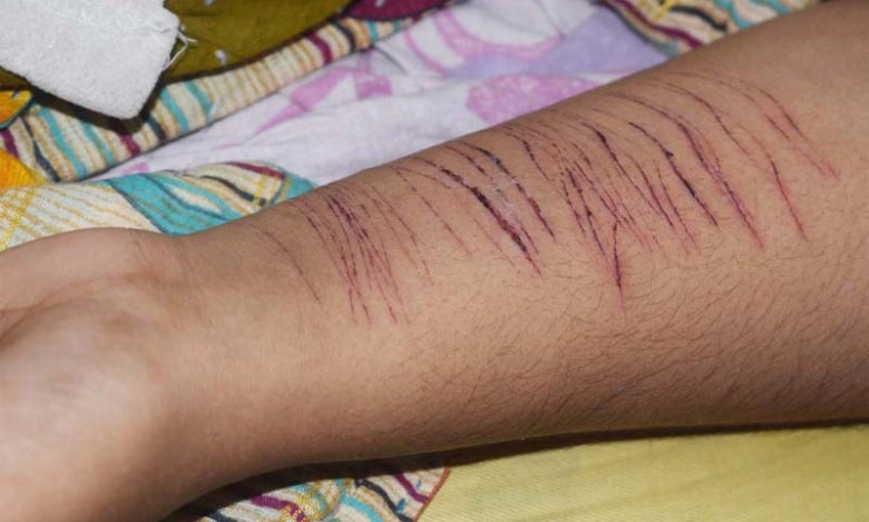 ২০২৫ সালের সেরা হাত কাটা পিক ডাউনলোড করুন | Hat Katar Pic Women